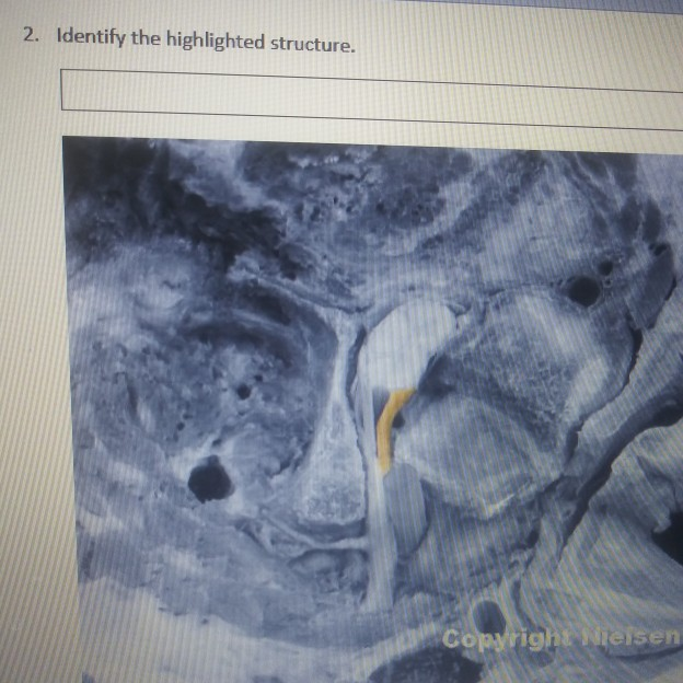 Solved 2. Identify the highlighted structure. Copyright | Chegg.com