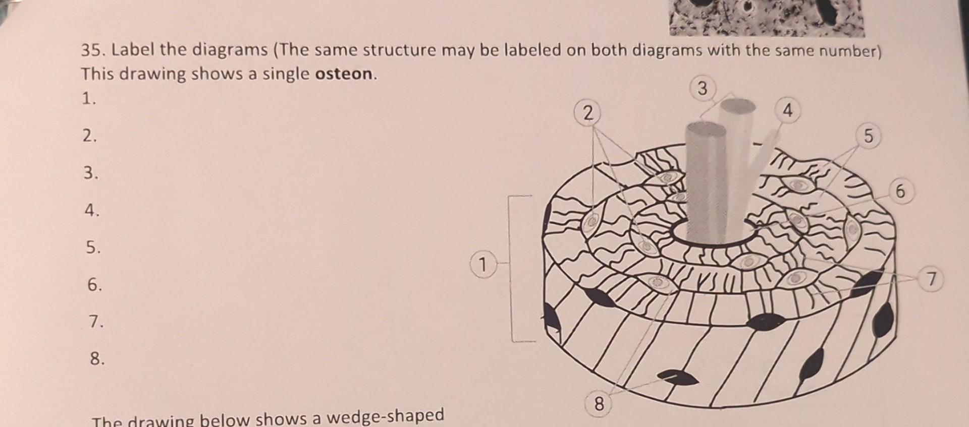 Solved 35. Label the diagrams (The same structure may be | Chegg.com