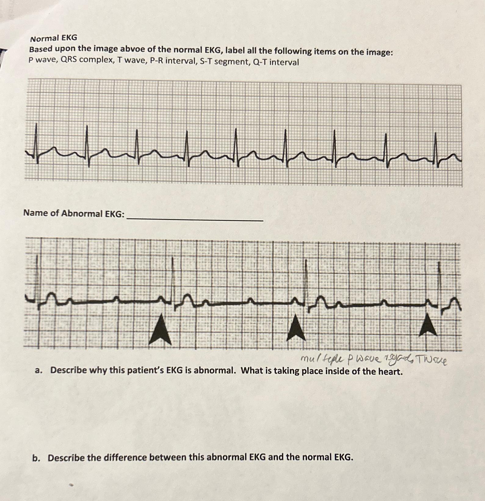 Solved Normal EKGBased upon the image abvoe of the normal | Chegg.com
