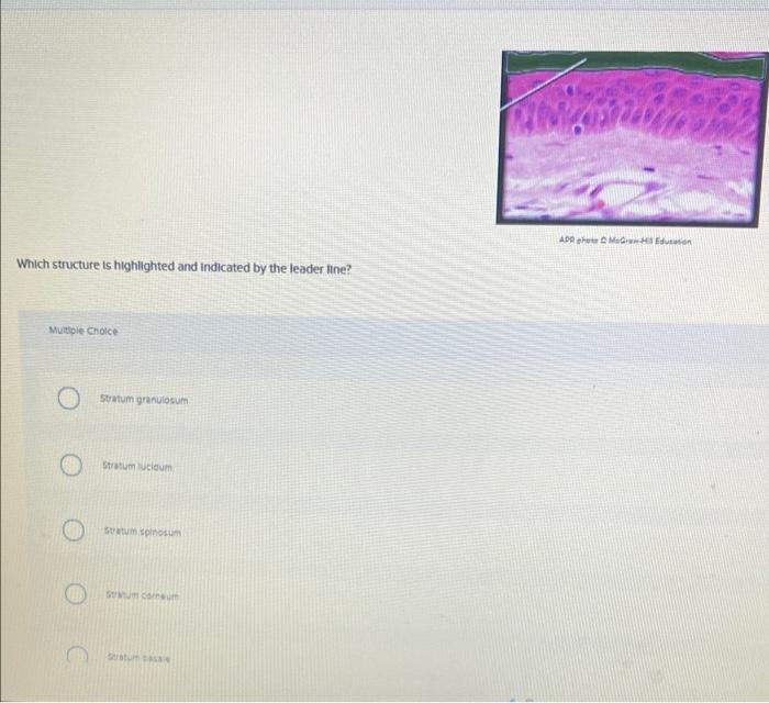Solved ADAMG Which structure is highlighted and indicated by | Chegg.com