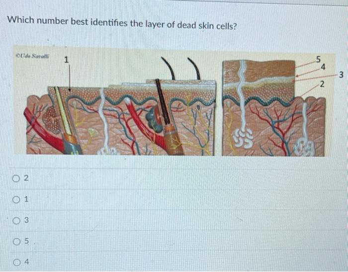 Solved Which number best identifies the layer of dead skin | Chegg.com