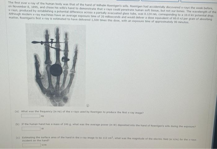 Solved The first ever x-ray of the human body was that of | Chegg.com
