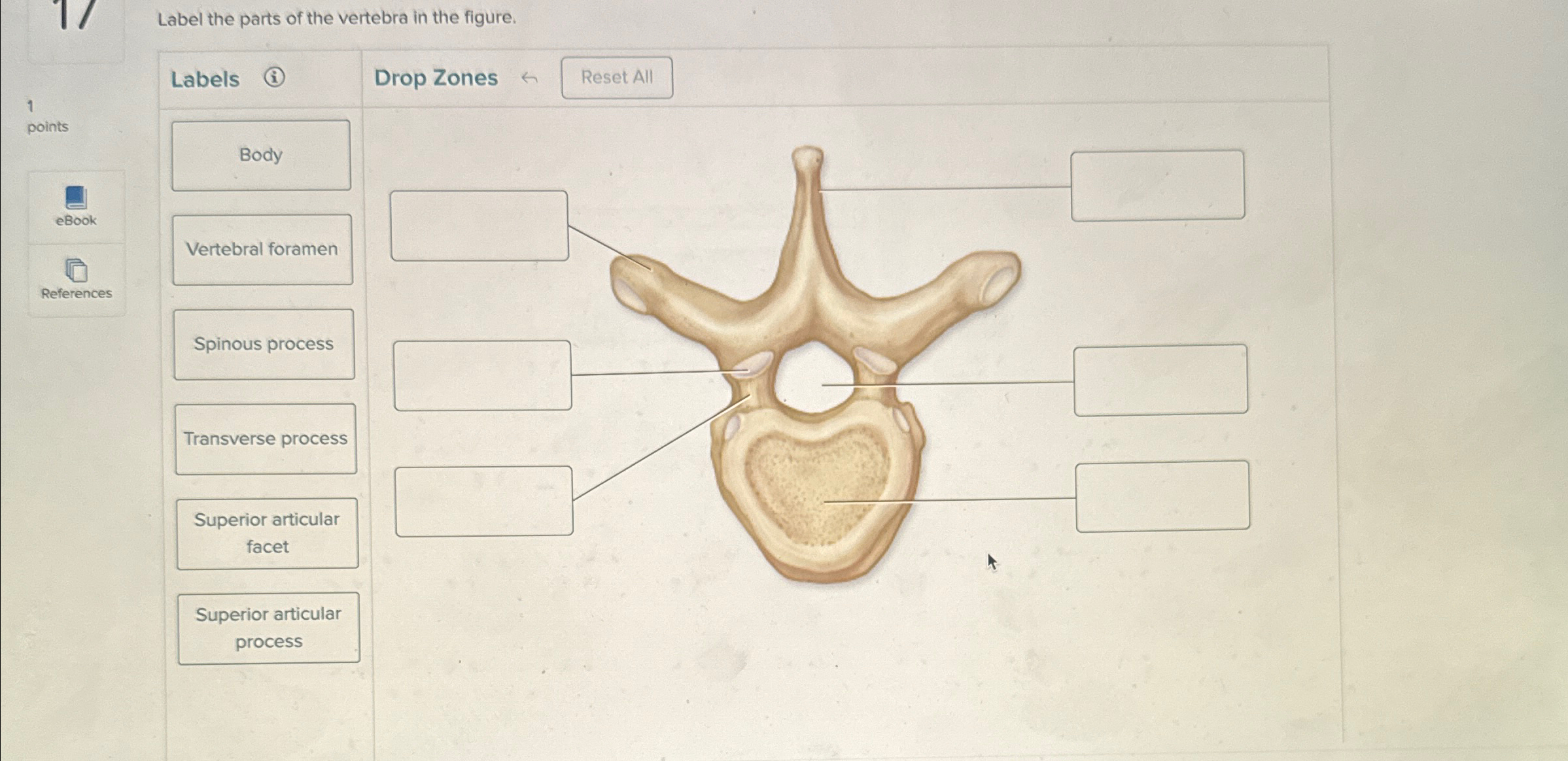 Solved 1?Label the parts of the vertebra in the | Chegg.com