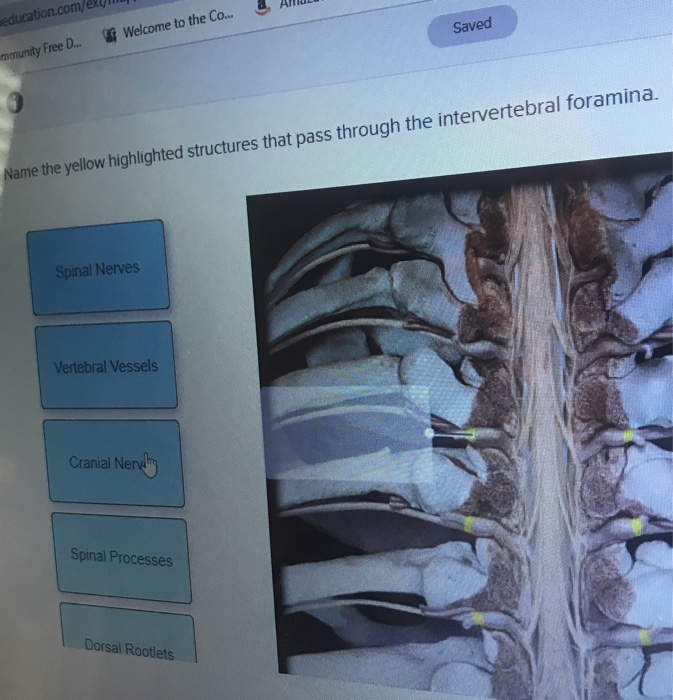 education.com/ Welcome to the Co... Saved mmunity | Chegg.com