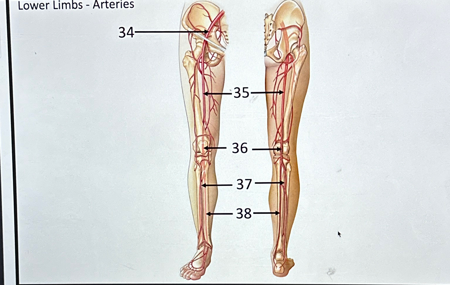 Solved Lower Limbs - ﻿Arteries | Chegg.com