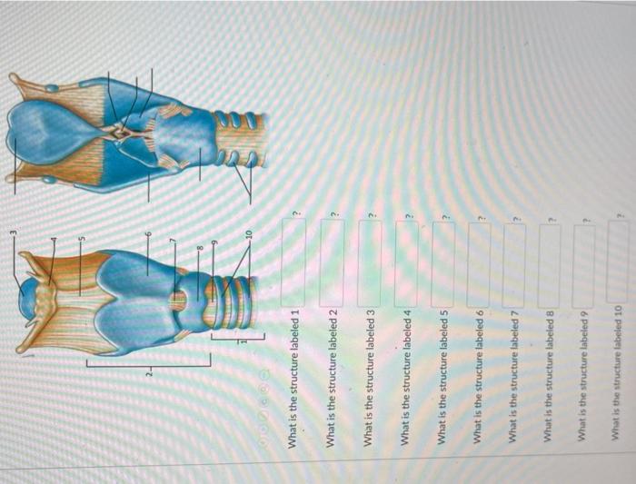 Solved What is the structure labeled 1 ? What is the | Chegg.com