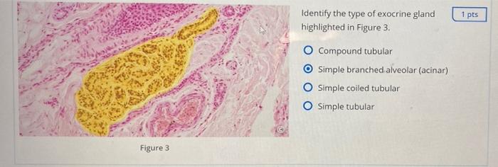 Solved 1 2 3 4 5 Identify the type of epithelium highlighted | Chegg.com