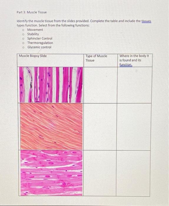 Solved Part 3: Muscle Tissue Identify the muscle tissue from | Chegg.com