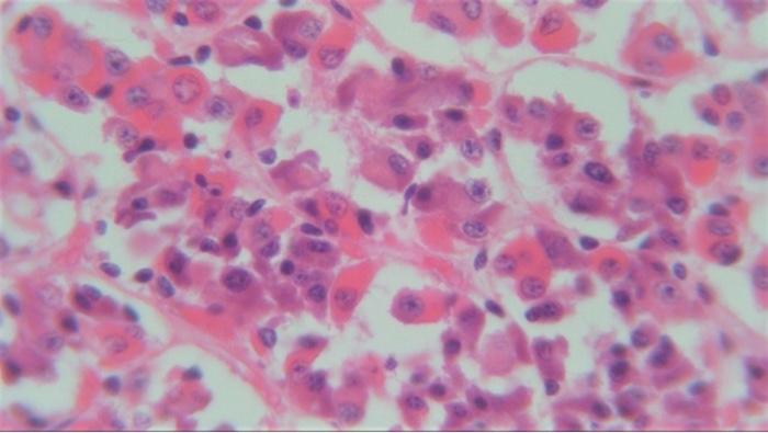 Solved label an acidophil cell and a basophil cell and | Chegg.com