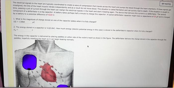 Solved The electrical signals to the heart are typically | Chegg.com