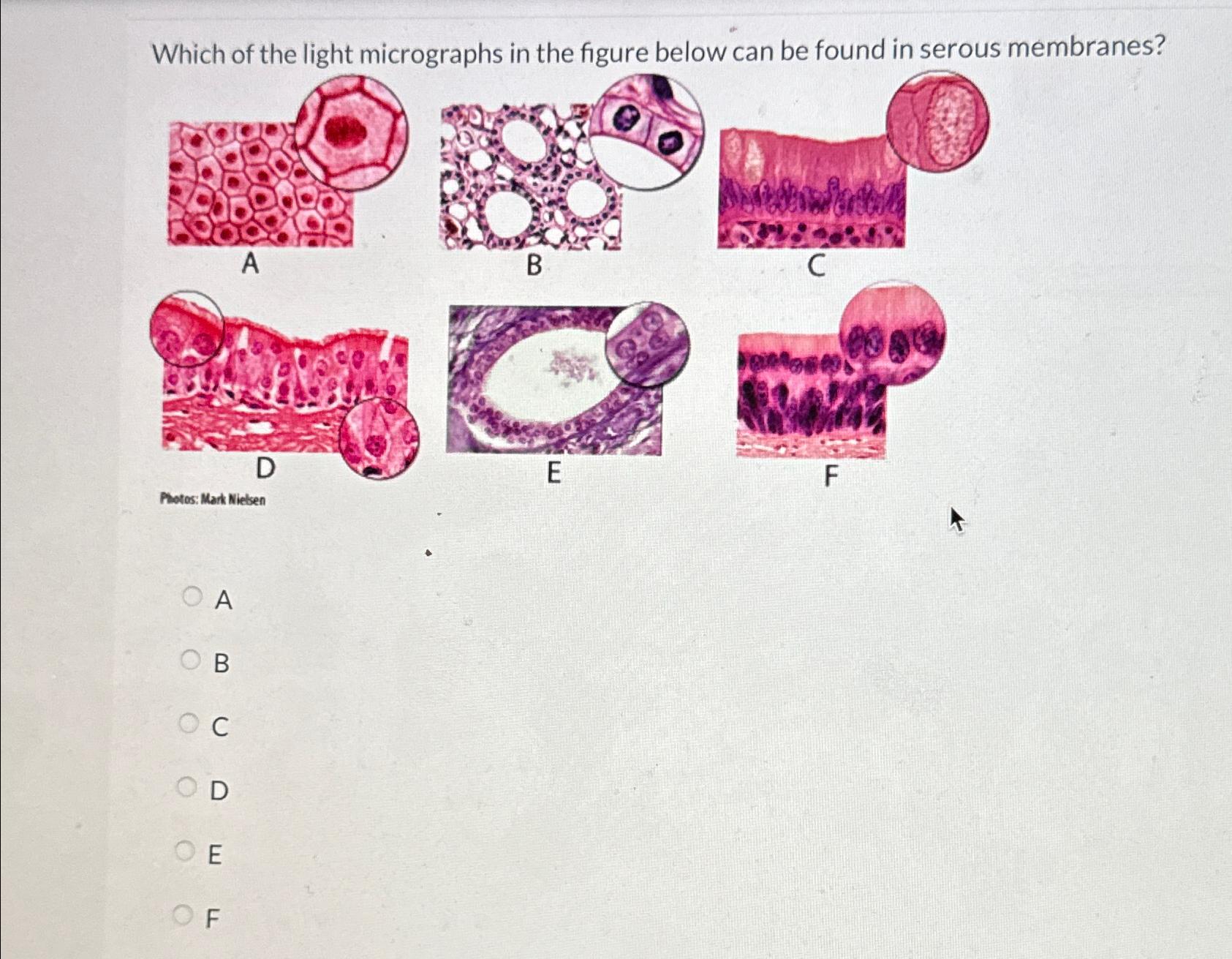 Solved Which of the light micrographs in the figure below | Chegg.com