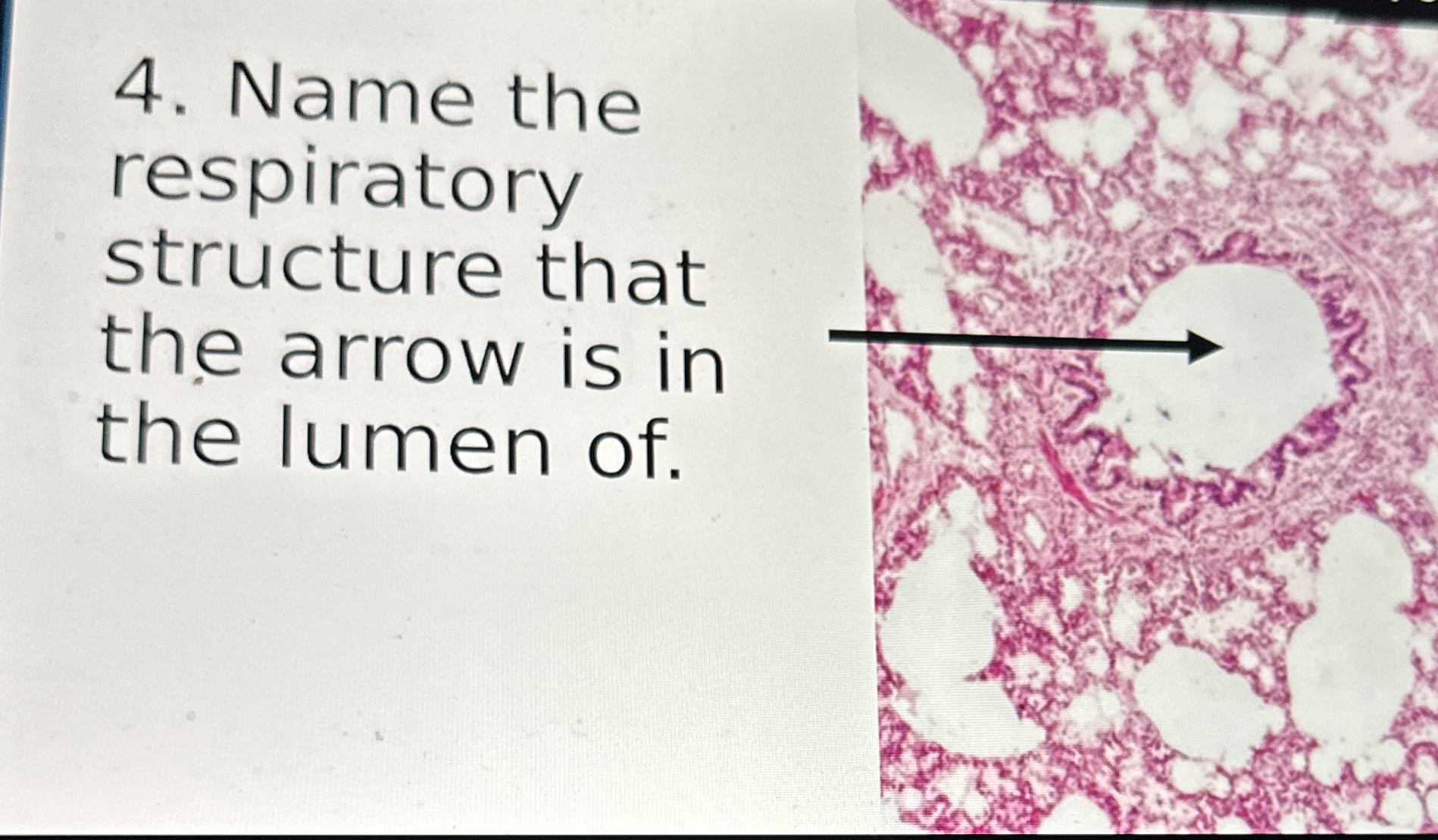 Solved Name the respiratory structure that the arrow is in | Chegg.com