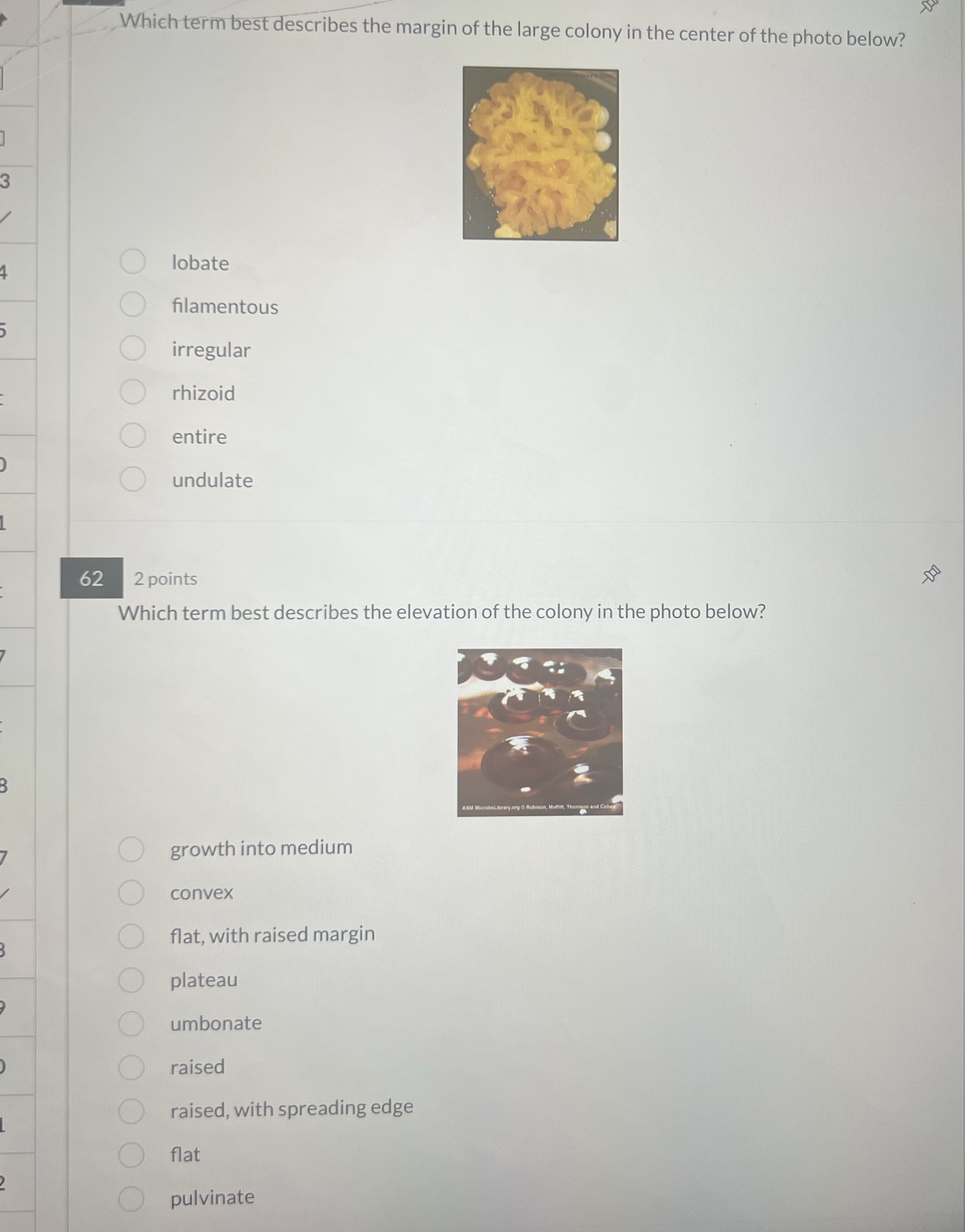 Solved Which term best describes the margin of the large | Chegg.com