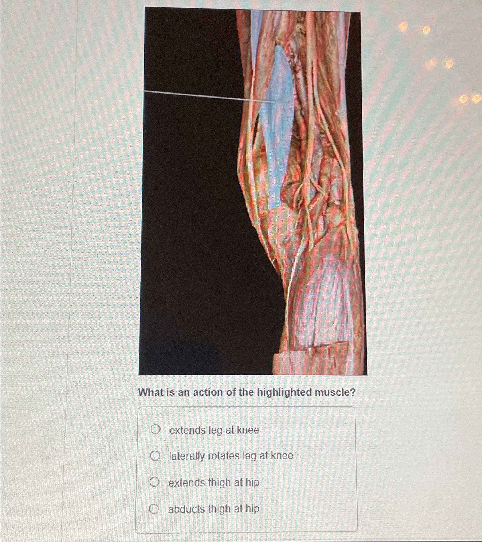 Solved What is an action of the highlighted muscle?extends | Chegg.com