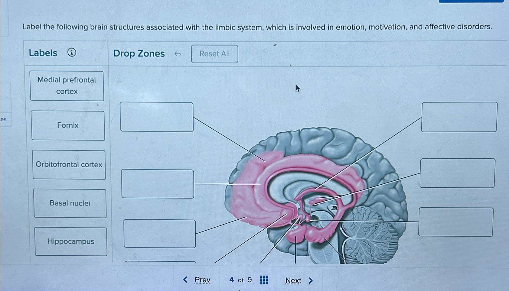 Solved Label the following brain structures associated with | Chegg.com