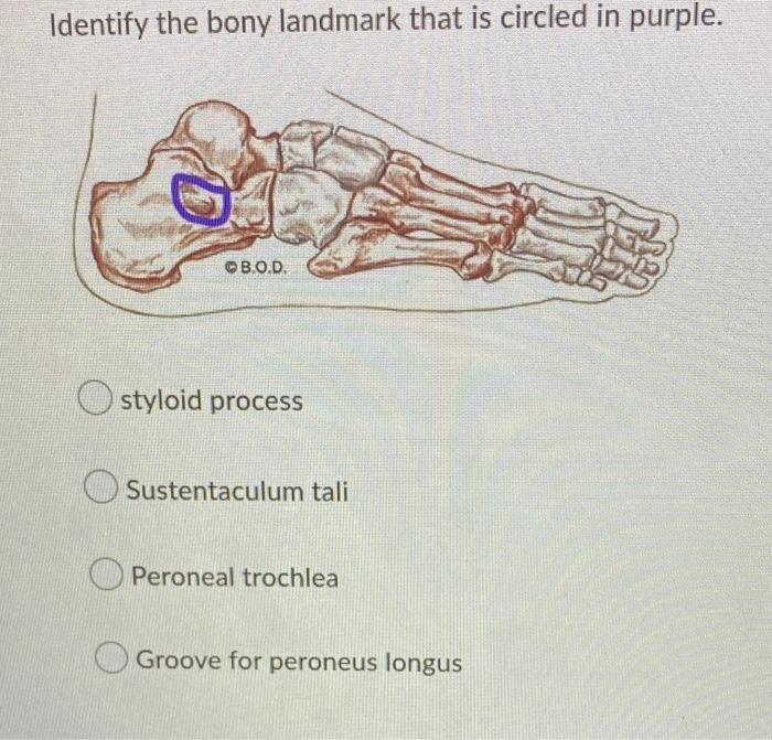 Solved Identify the bony landmark that is circled in purple. | Chegg.com