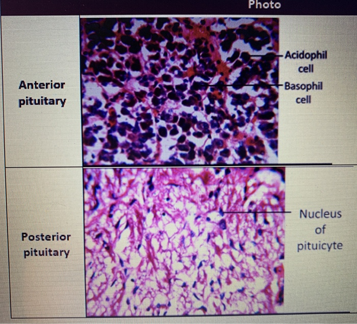 Solved Photo Acidophil cell Basophil cell Anterior pituitary | Chegg.com