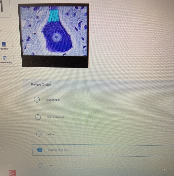 Solved eBook References Multiple Choice axon hillock axon | Chegg.com