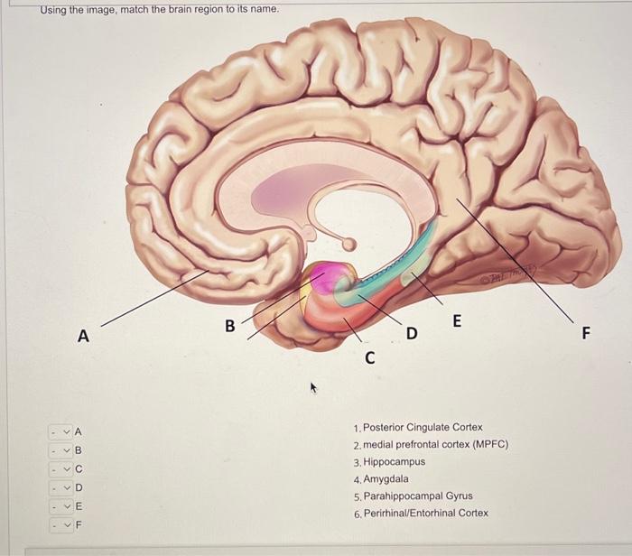 Solved Usina the imade. match the brain region to its name. | Chegg.com