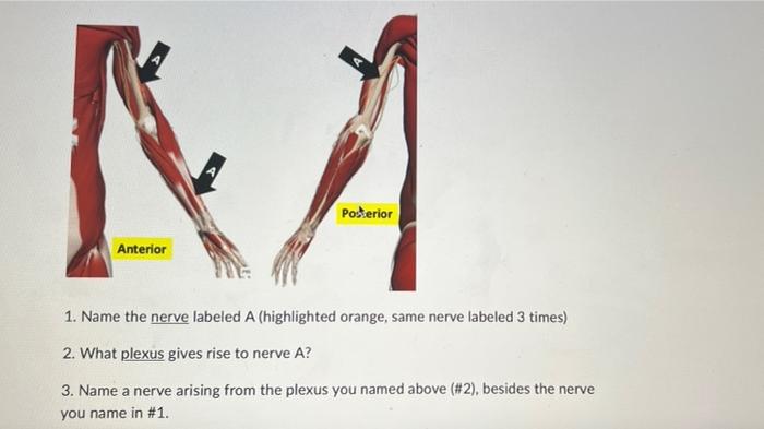 Solved J 1. Name the specific meninx (singular form of | Chegg.com