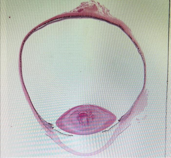Solved label 3 structures of the monkey eye slide | Chegg.com