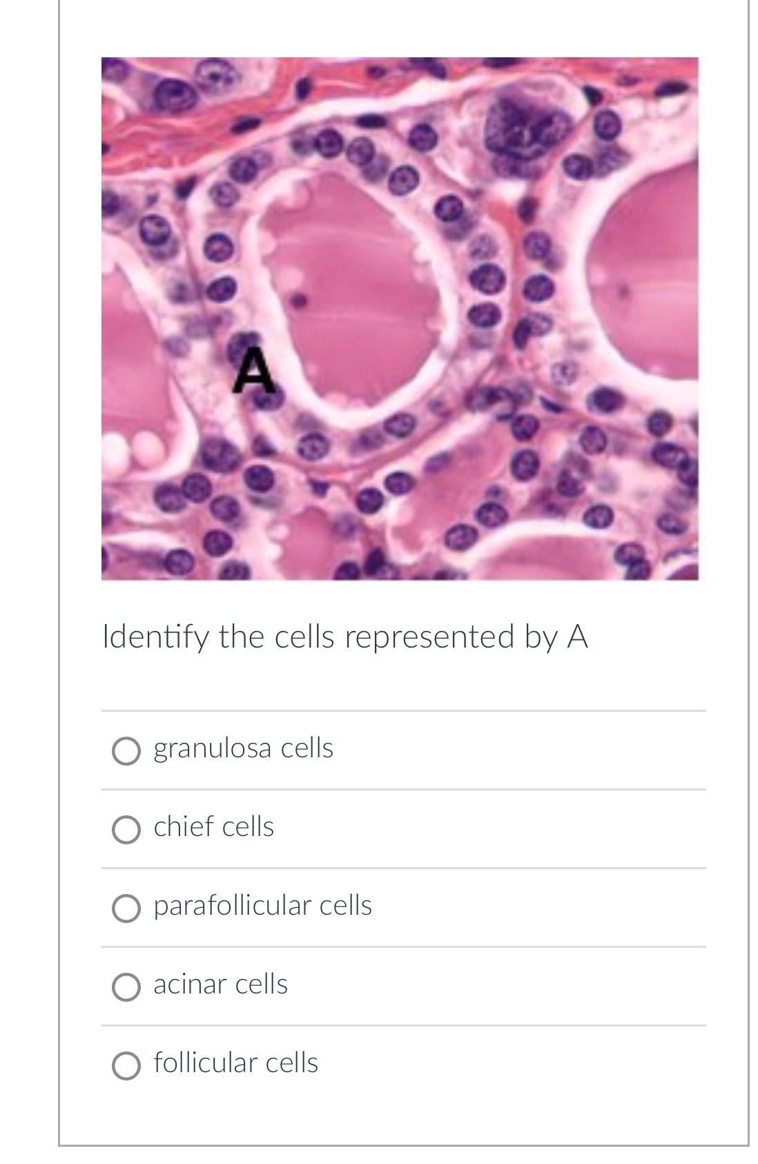Identify the cells represented by Agranulosa | Chegg.com