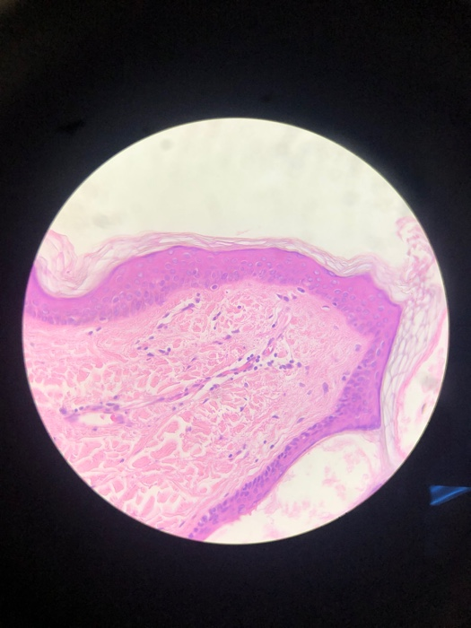 Integumentary System Section Labeling 1. Label the | Chegg.com