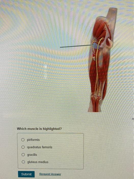 Solved Which muscle is highlighted? O piriformis O quadratus | Chegg.com