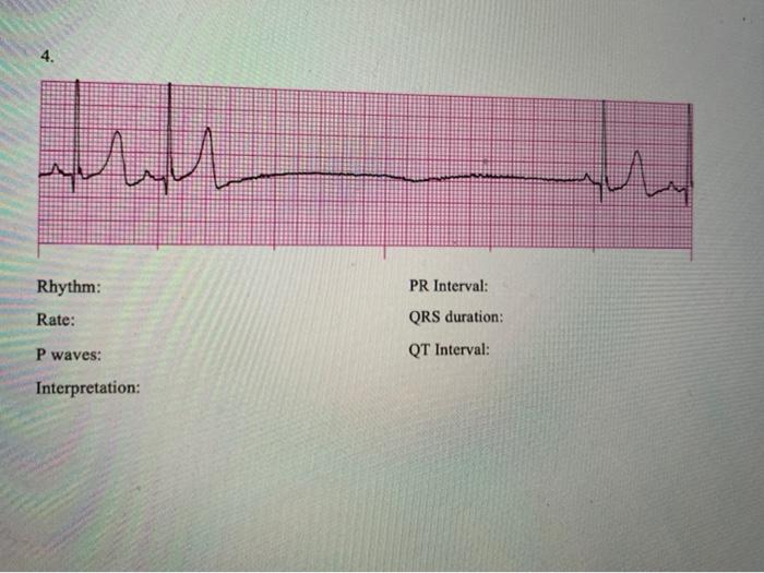 Solved 4. tur uchy Rhythm: PR Interval: : Rate: QRS | Chegg.com