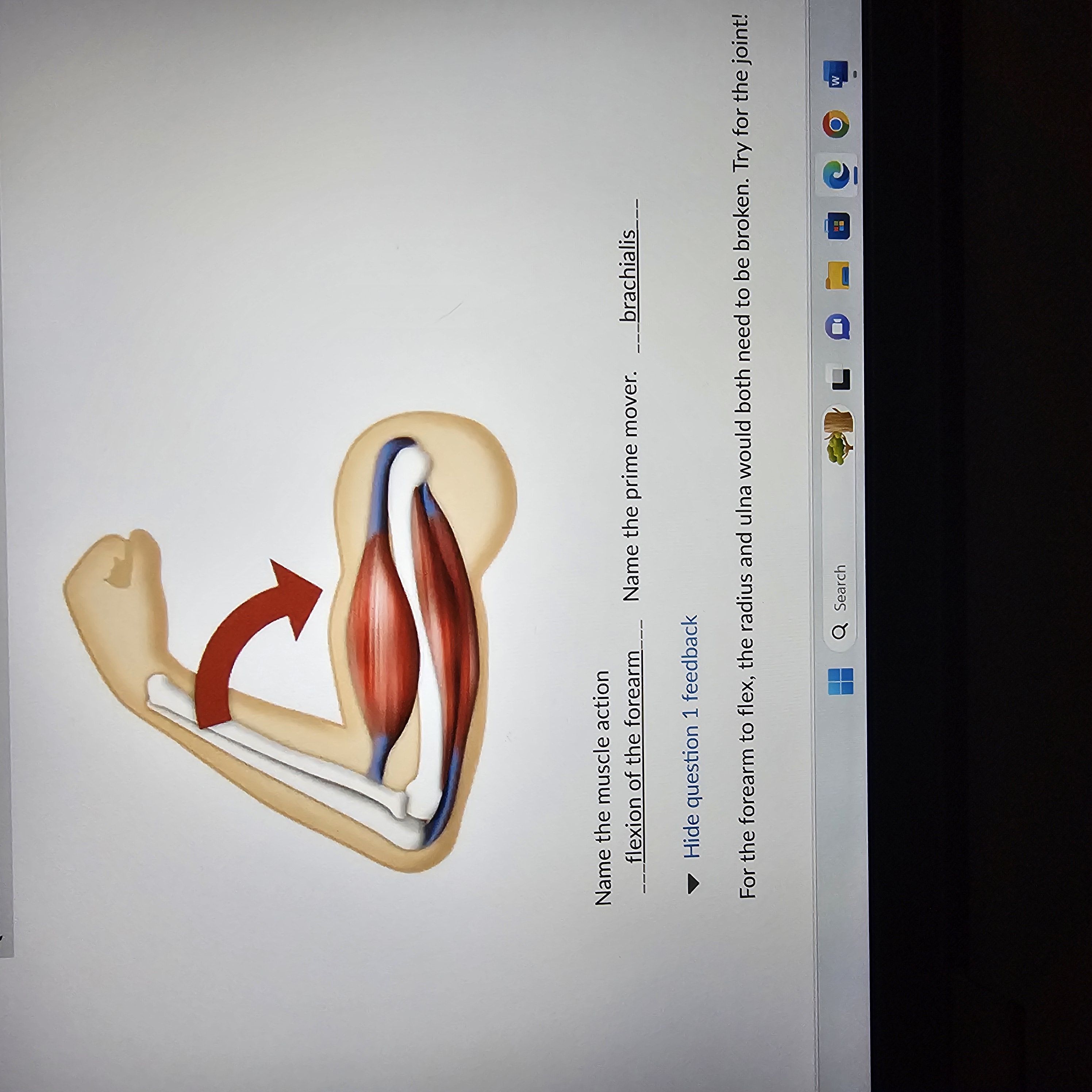 Solved Name the muscle actionName the prime mover. | Chegg.com