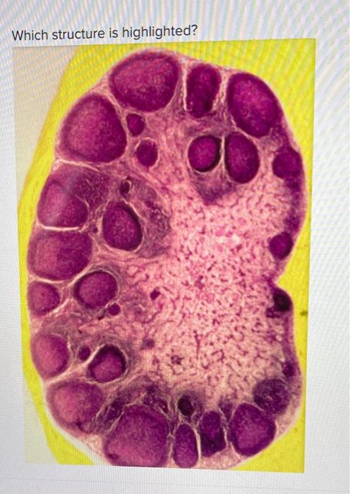 Solved hinhlinhtor? trabecula of lymph node capsule of | Chegg.com