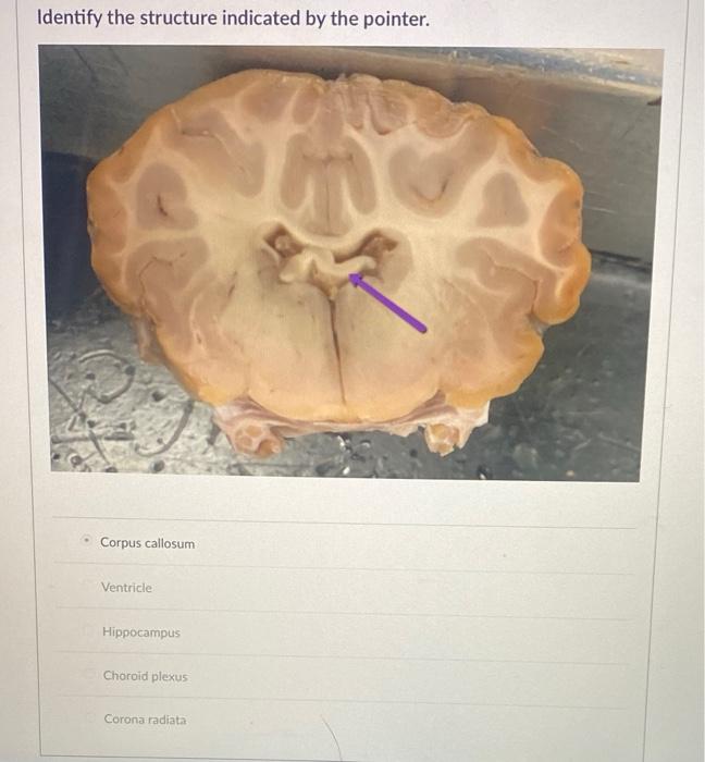 Solved Identify the structure indicated by the pointer. | Chegg.com
