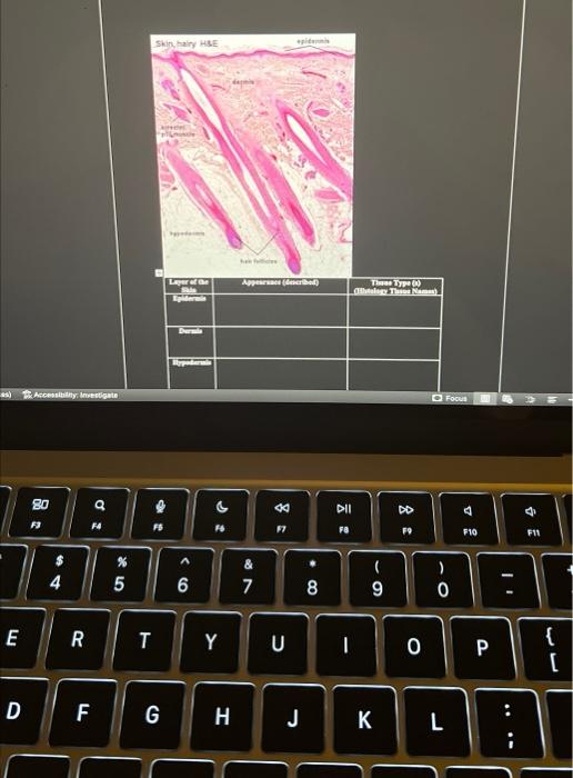 Solved Activity 1. Skin Slides 1. Observe the palmar skin | Chegg.com