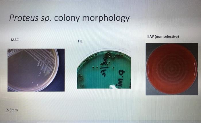 Solved Escherichia coli colony morphology HE MAC 1-5mm | Chegg.com