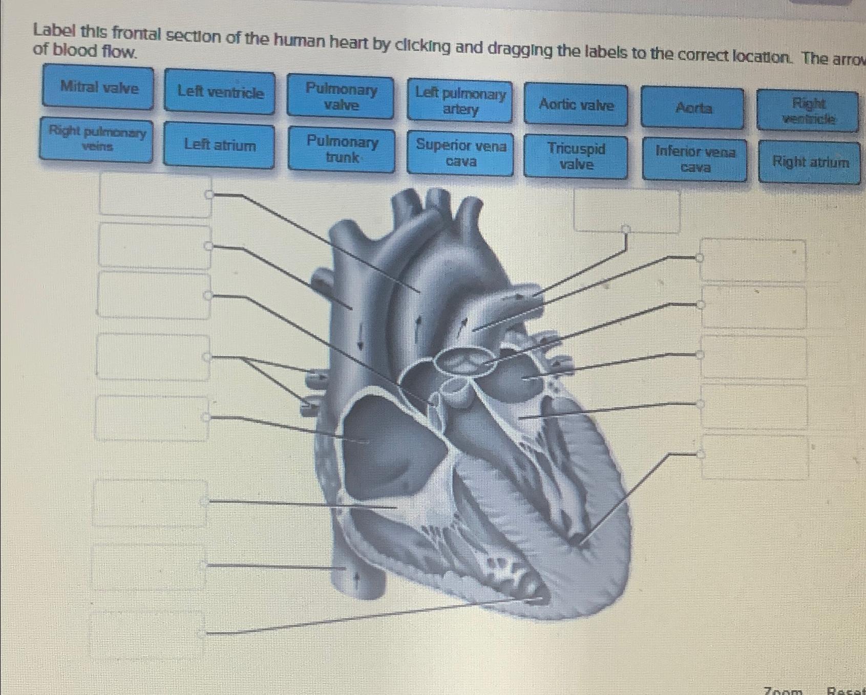 Solved Frontal section of the human heart | Chegg.com