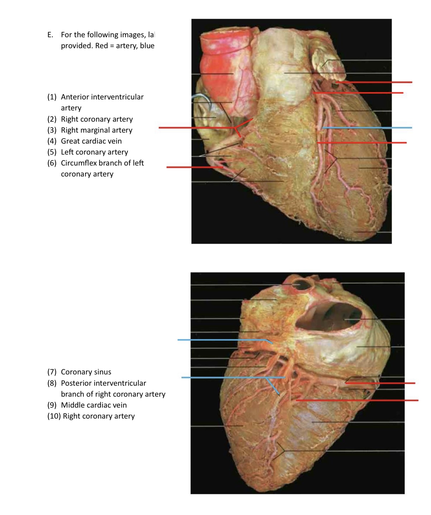 Solved E. ﻿For the following images, la provided. Red = | Chegg.com