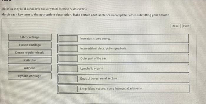 Solved Match each type of connective tissue with its | Chegg.com Solved Match each type of connective tissue with its | Chegg.com