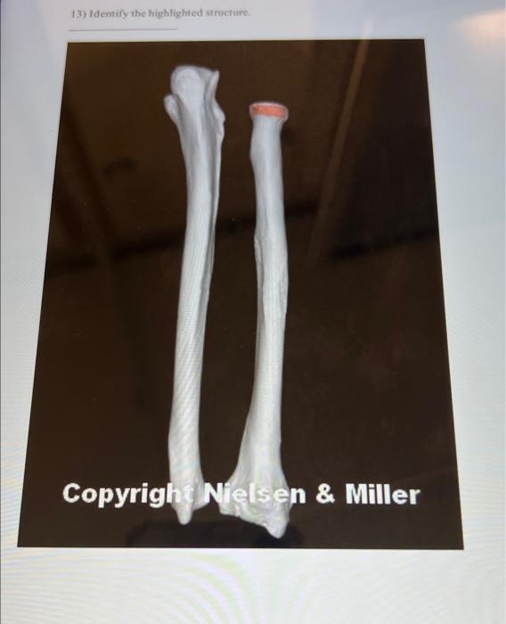 1) Identify the highlighted area of the following | Chegg.com