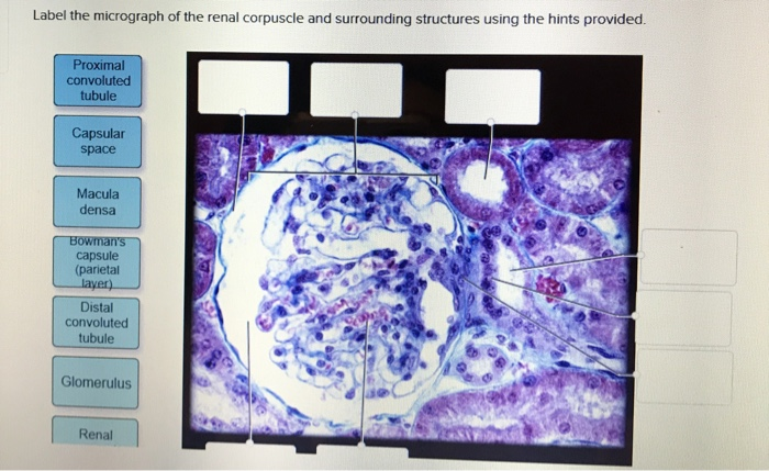 Label the micrograph of the renal corpuscle and | Chegg.com