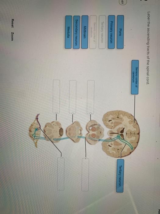 Solved He Label the ascending tracts of the spinal cord. | Chegg.com