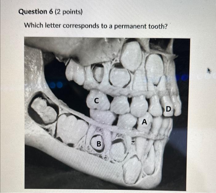 Solved Which letter corresponds to a permanent tooth? | Chegg.com