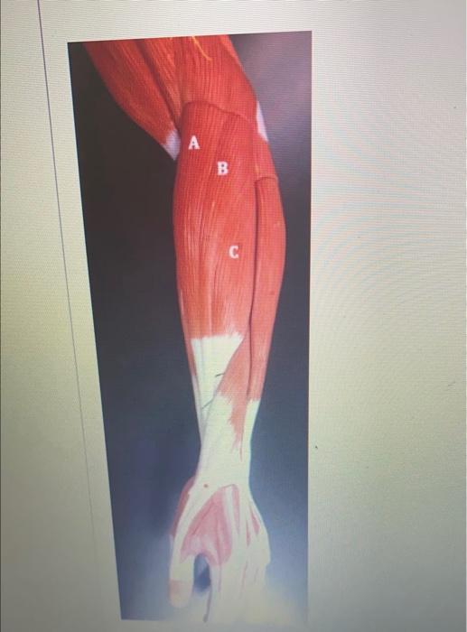 Solved A B C | Chegg.com