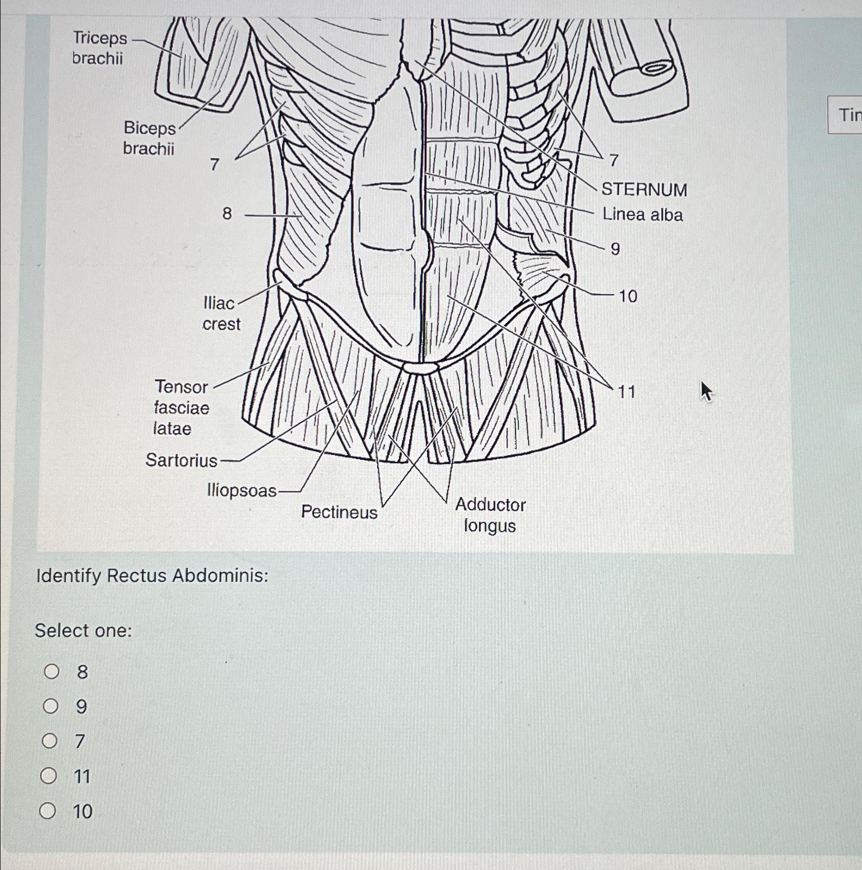Solved Identify Rectus Abdominis:Select one:8971110 | Chegg.com