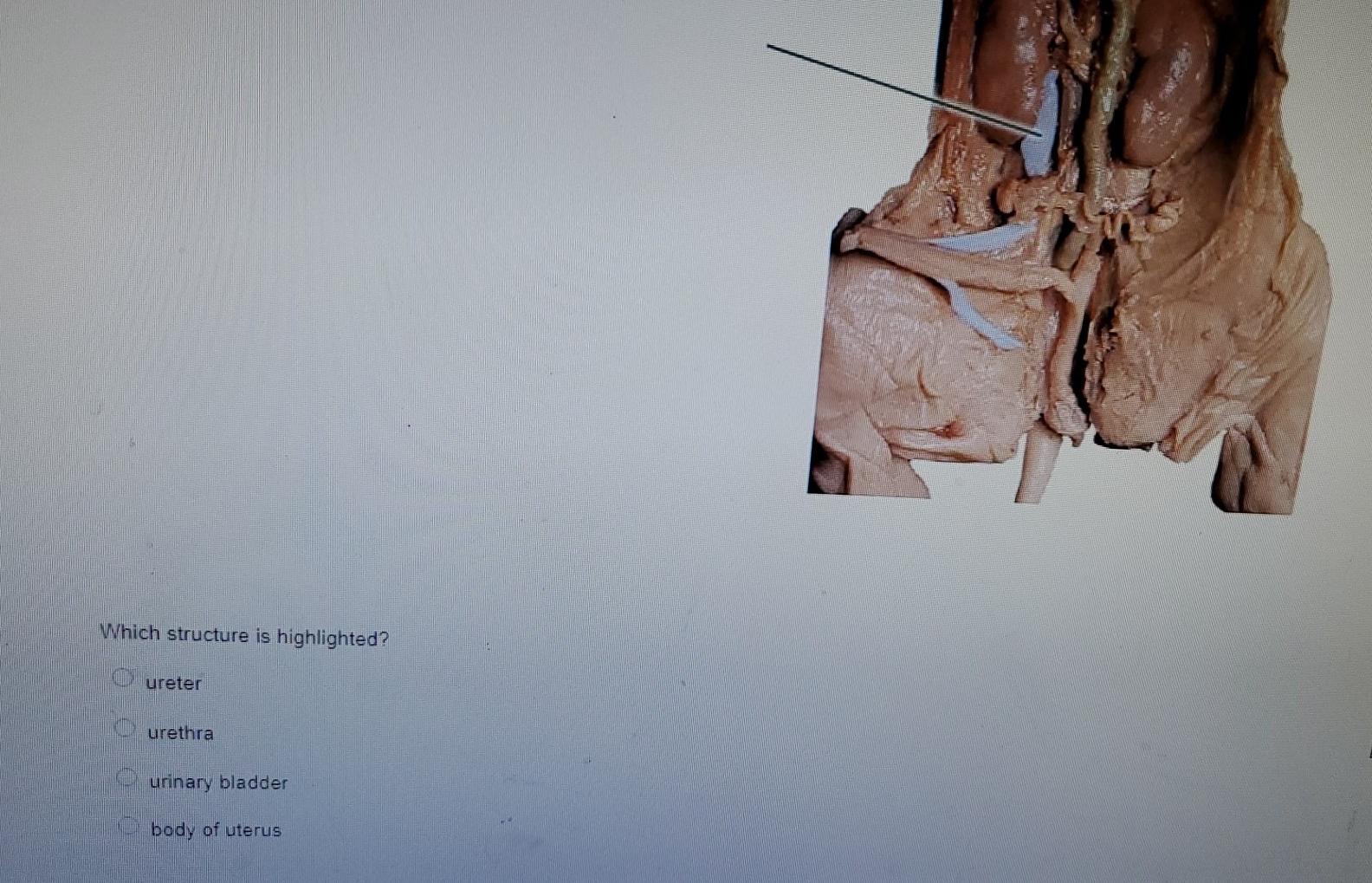 Solved Which structure is highlighted? ureter urethra | Chegg.com