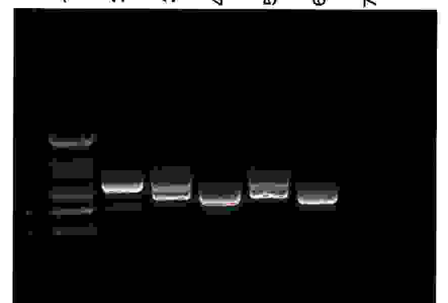 Solved results interpetation for huntington diseases 1. DNA | Chegg.com