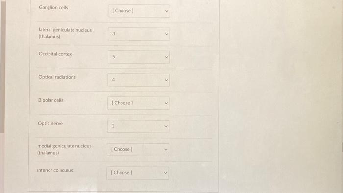 [Solved]: Place the steps in the neural pathway for vision