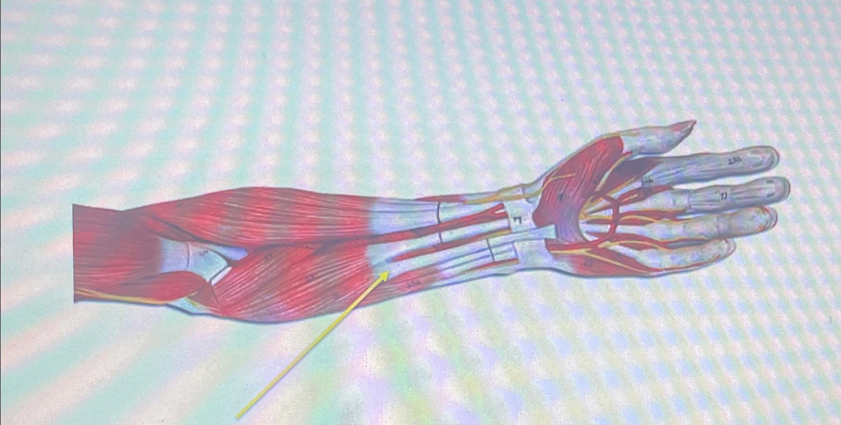 Solved What is this muslce? | Chegg.com