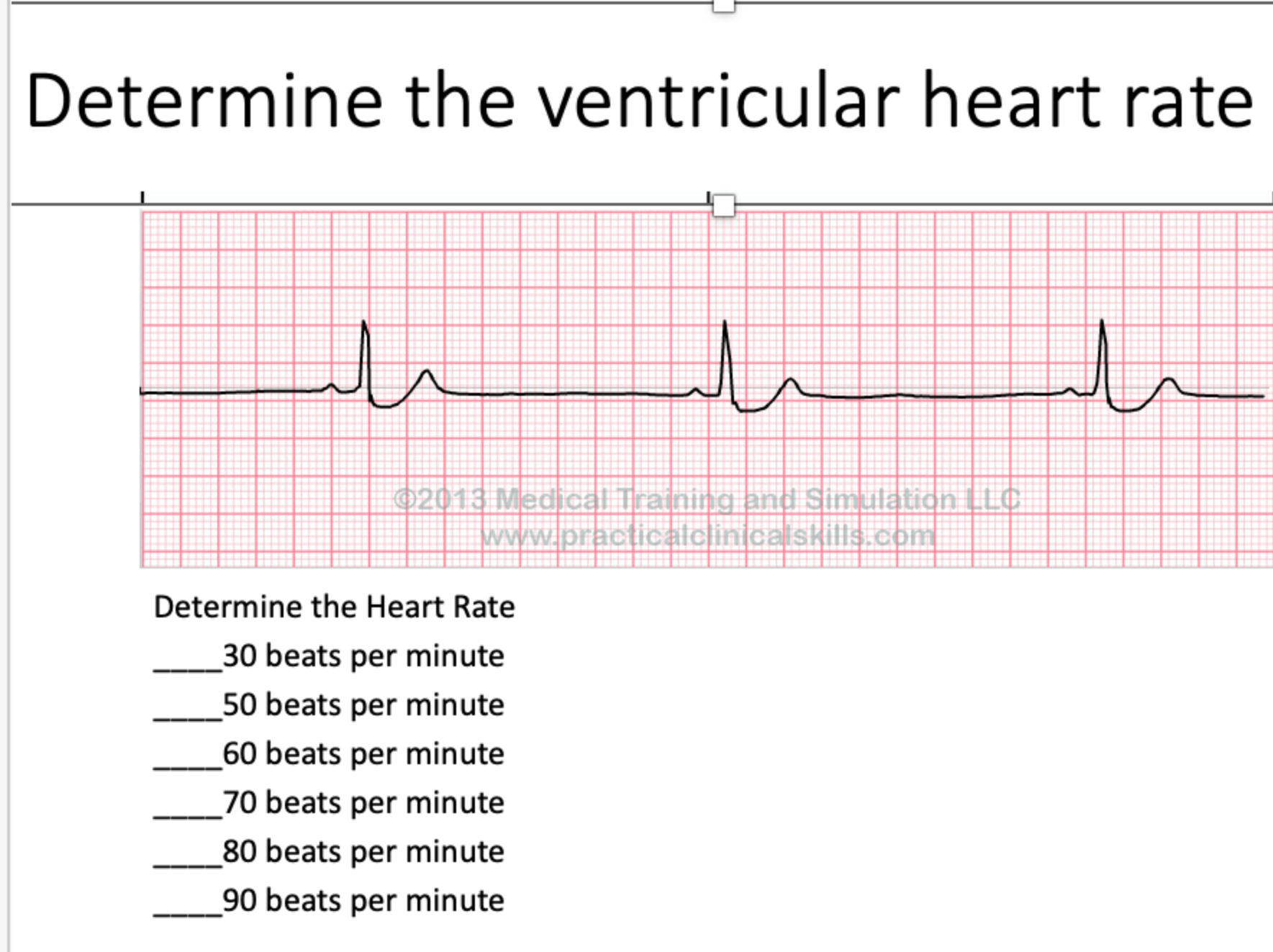 Solved Determine the ventricular heart rateDetermine the | Chegg.com