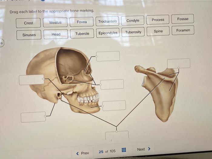 Solved Drag each label to the appropriate bone marking. | Chegg.com