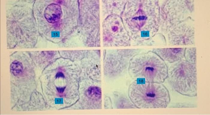 Solved Cell division- label it | Chegg.com